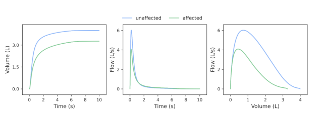 Lung Disease Prediction using Machine Learning - Analytics Yogi